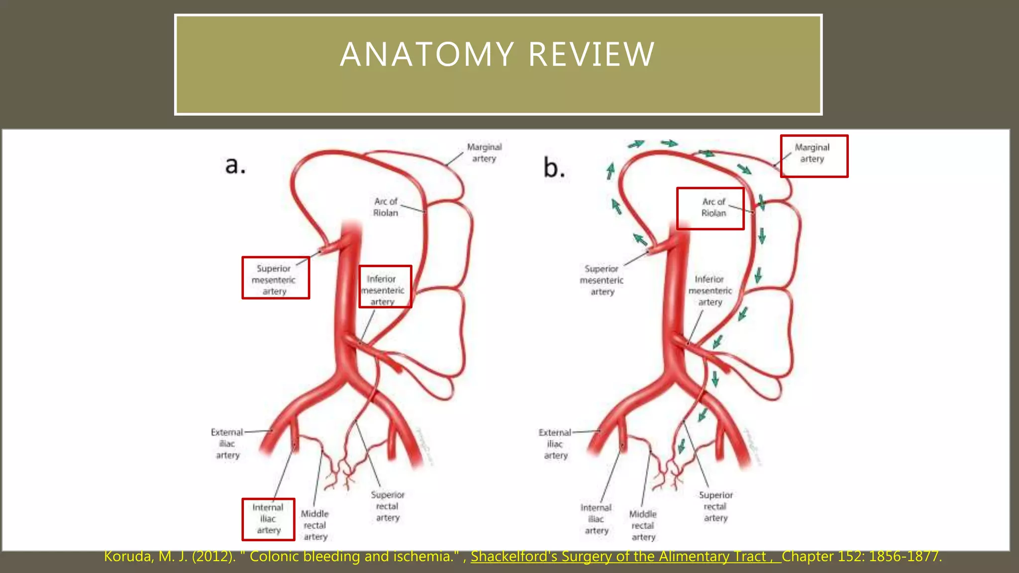 12.3.61 colonic ischemia in evar & open repair aaa | PPTX