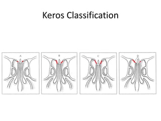 Pns paranasal sinuses | PPT