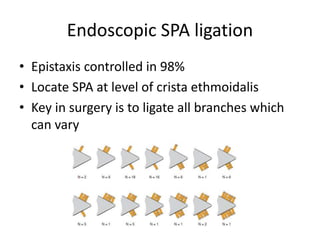 Pns paranasal sinuses | PPT