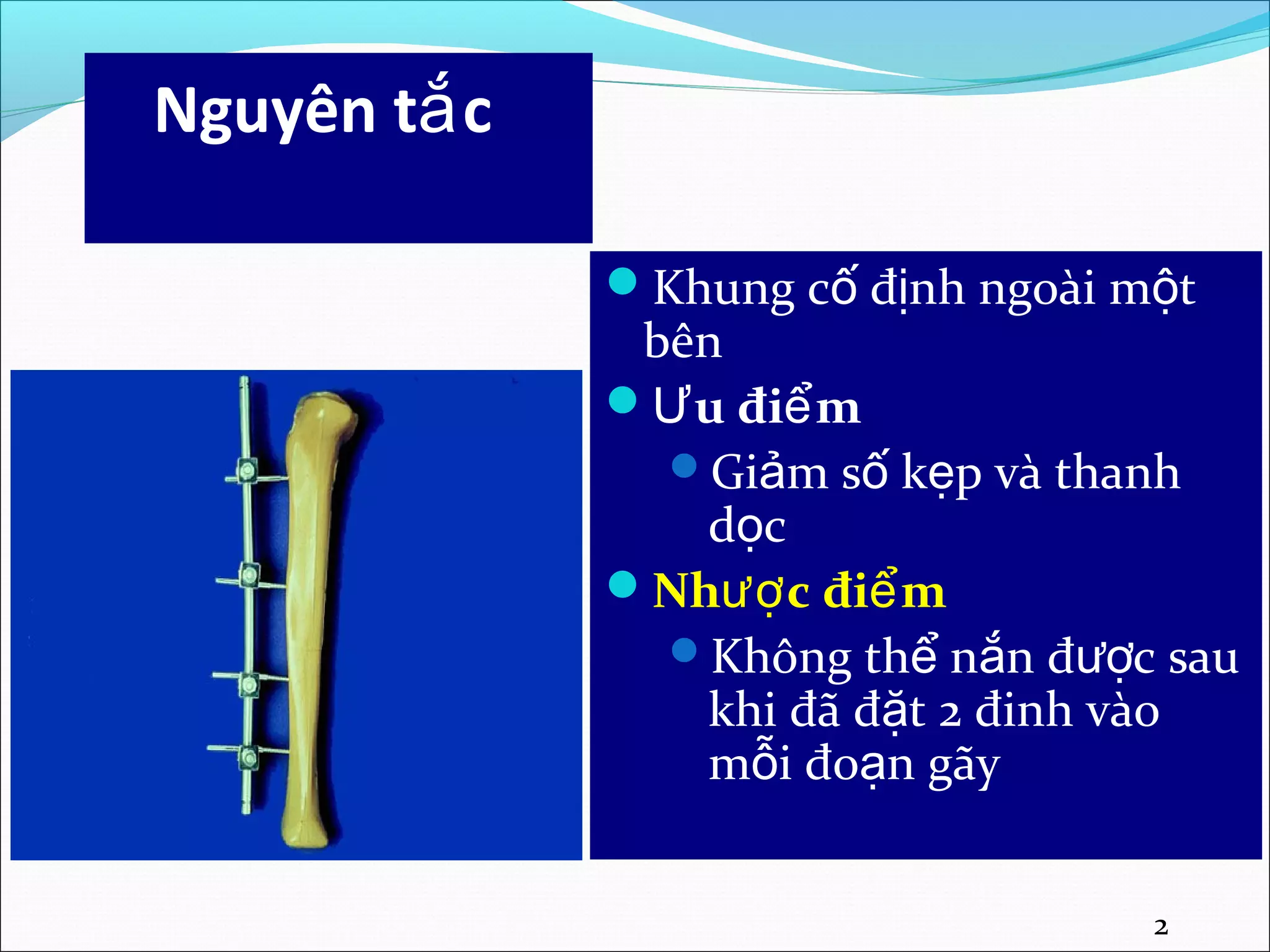 12. external fixation of tibial shaft v nese | PPT