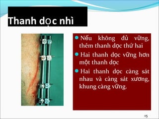 12. external fixation of tibial shaft v nese | PPT