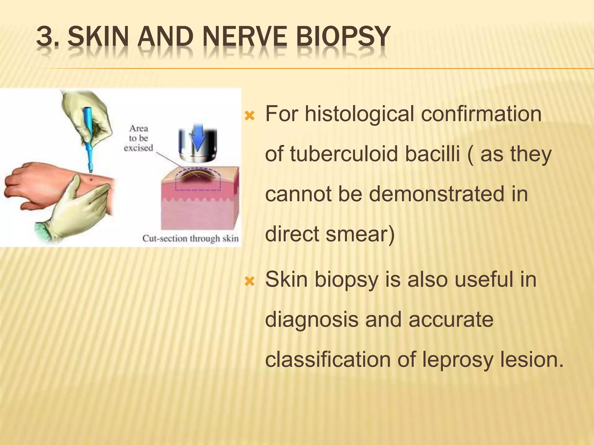 12. mycobacterium leprae | PPTX