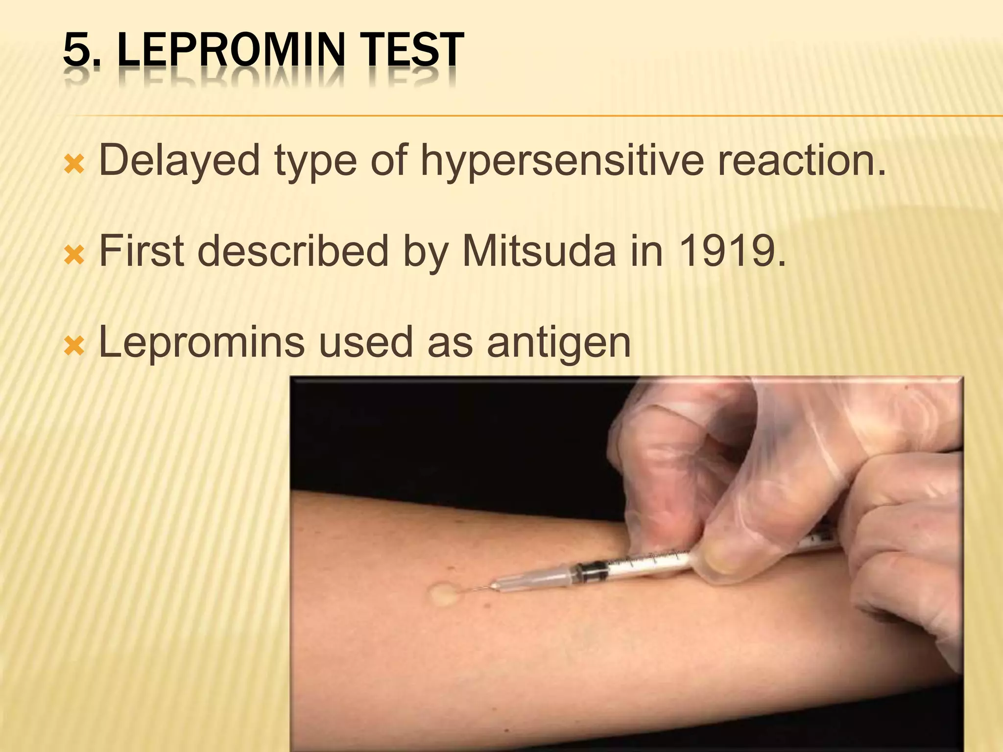 12. mycobacterium leprae | PPTX