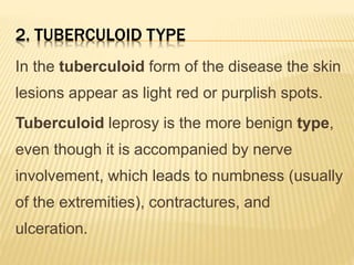 12. mycobacterium leprae | PPTX