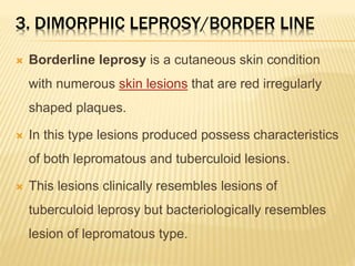 12. mycobacterium leprae | PPTX