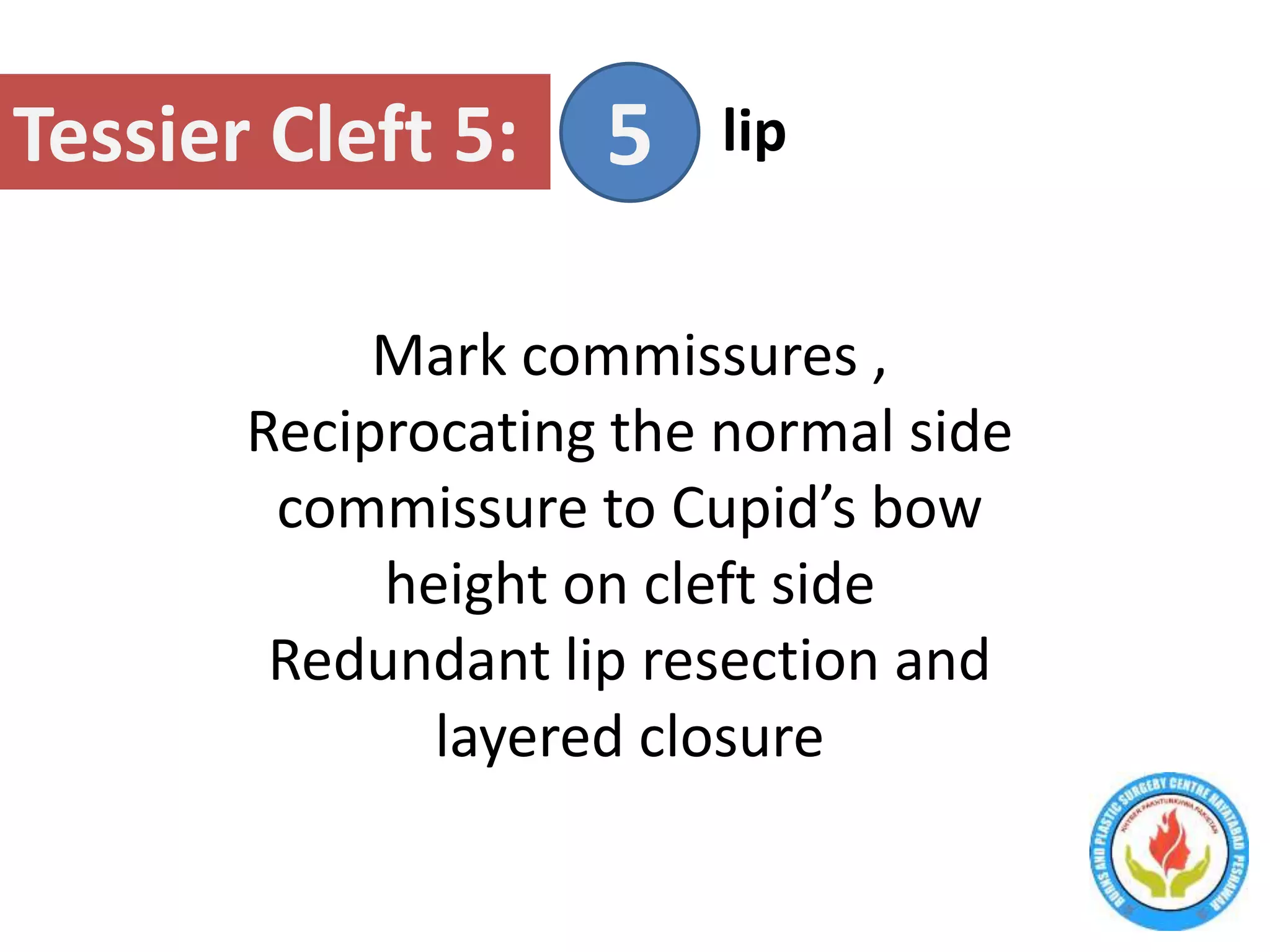 Craniofacial soft tissue reconstruction | PPT