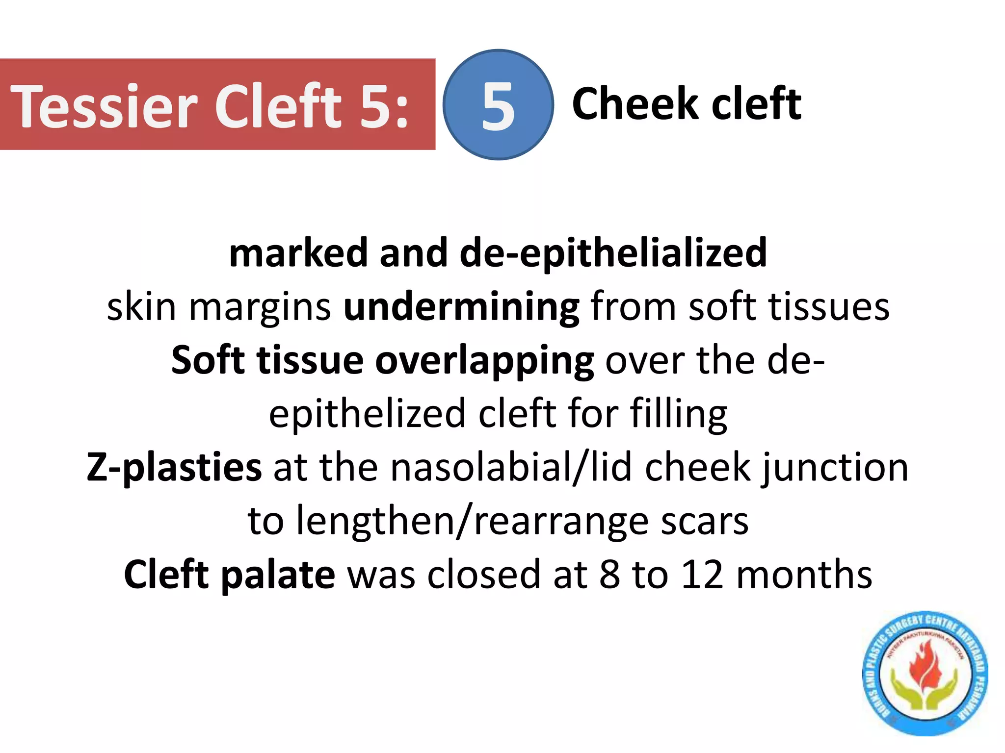 Craniofacial soft tissue reconstruction | PPT