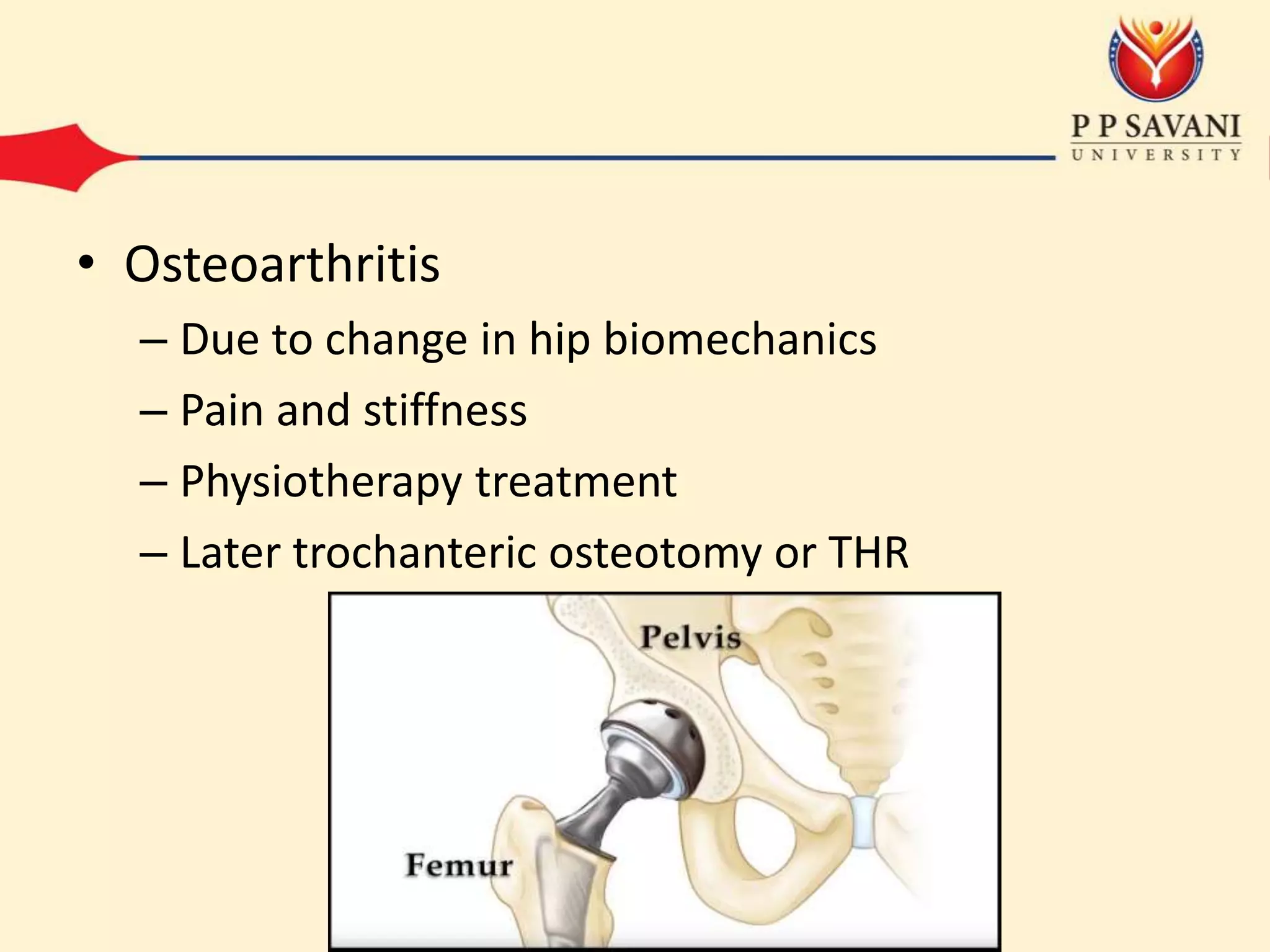 12. Inter trochanteric fracture | PPTX