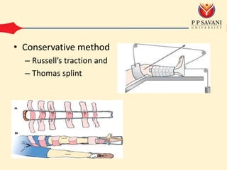 12. Inter trochanteric fracture | PPTX