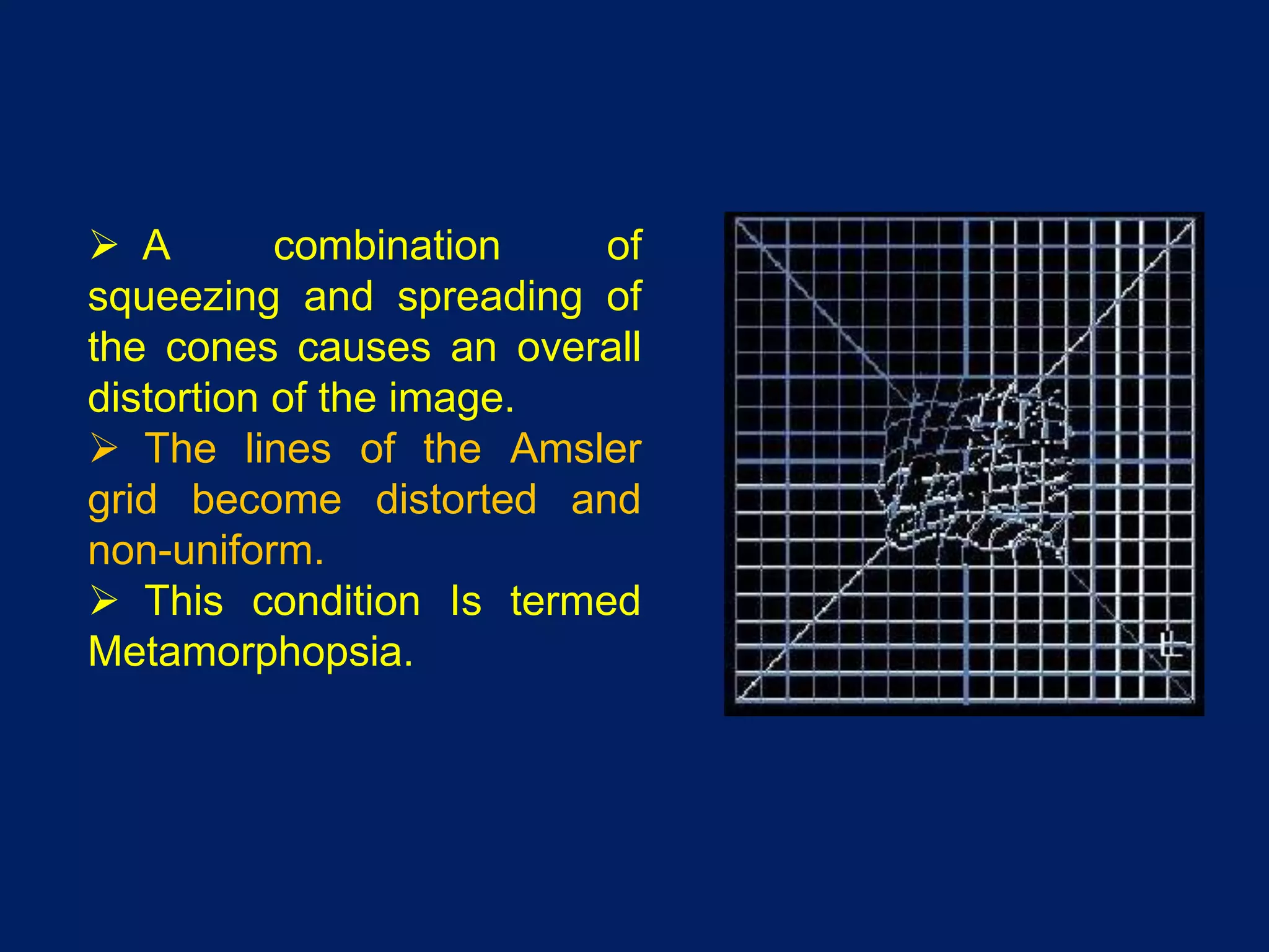 Macular function tests | PPT