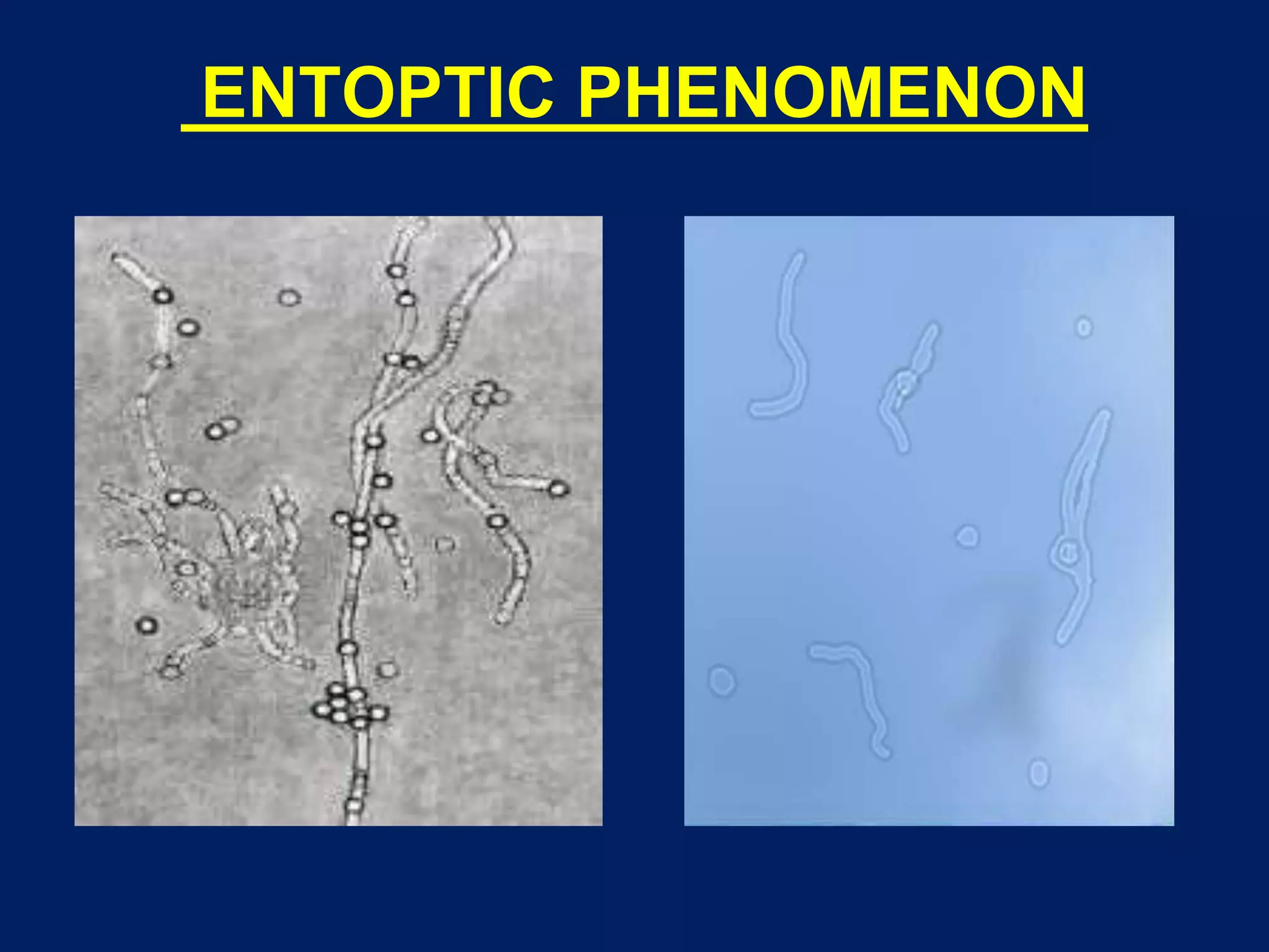 Macular function tests | PPT