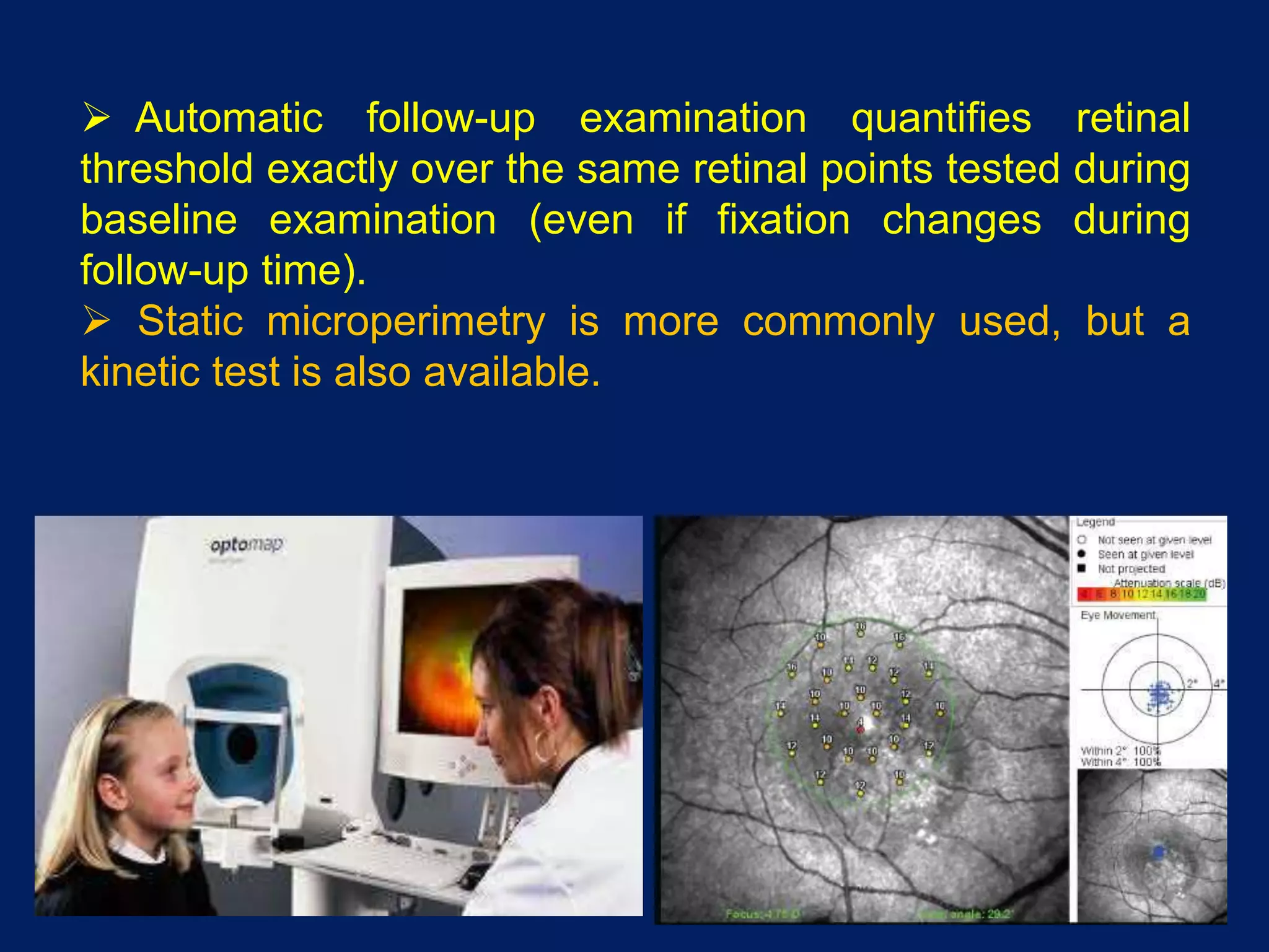 Macular function tests | PPT