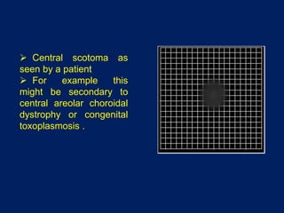 Macular function tests | PPT | Eye and Vision Conditions | Diseases and ...