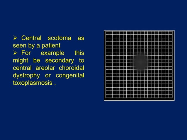 Macular function tests | PPT | Eye and Vision Conditions | Diseases and ...