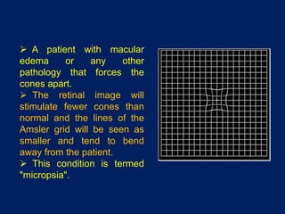 Macular function tests | PPT | Eye and Vision Conditions | Diseases and ...
