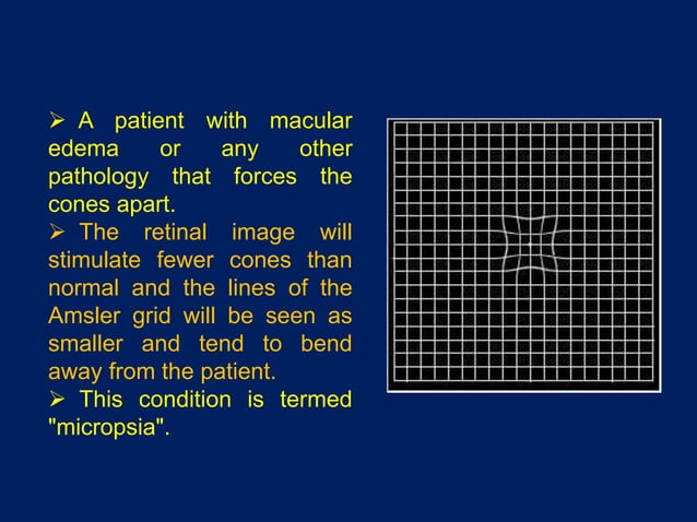 Macular function tests | PPT | Eye and Vision Conditions | Diseases and ...