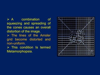 Macular function tests | PPT | Eye and Vision Conditions | Diseases and ...