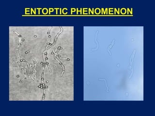 Macular function tests | PPT | Eye and Vision Conditions | Diseases and ...