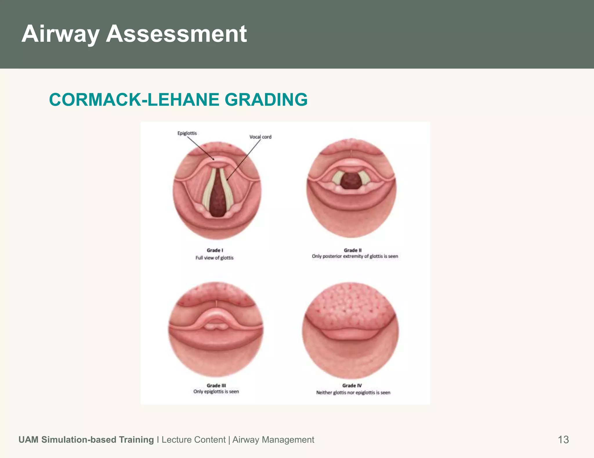 Airway Management | PPTX