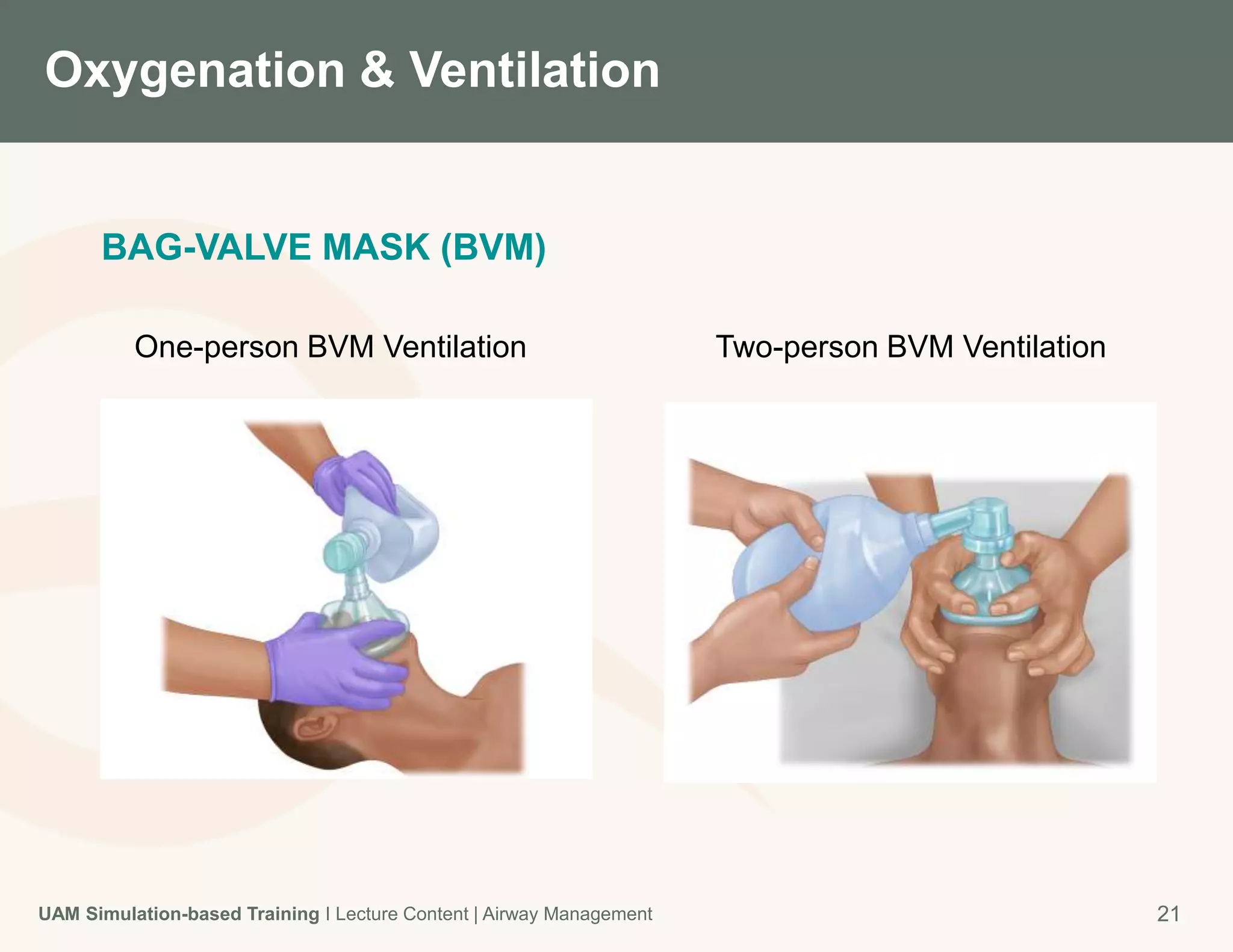 Airway Management | PPTX