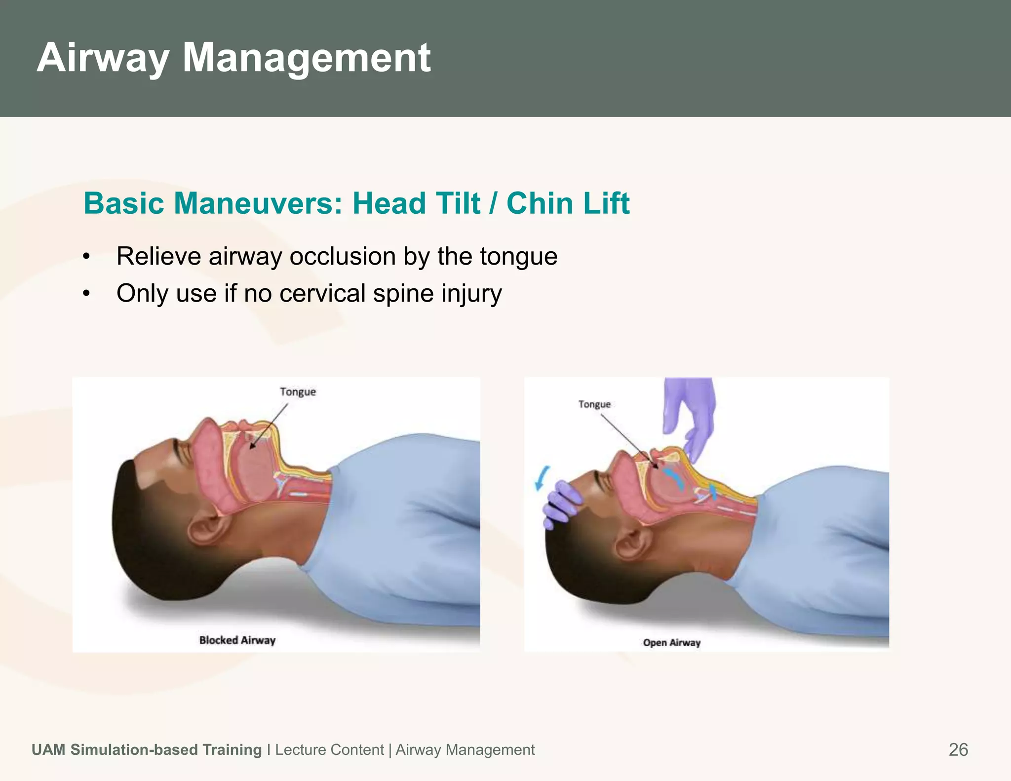 Airway Management | PPTX