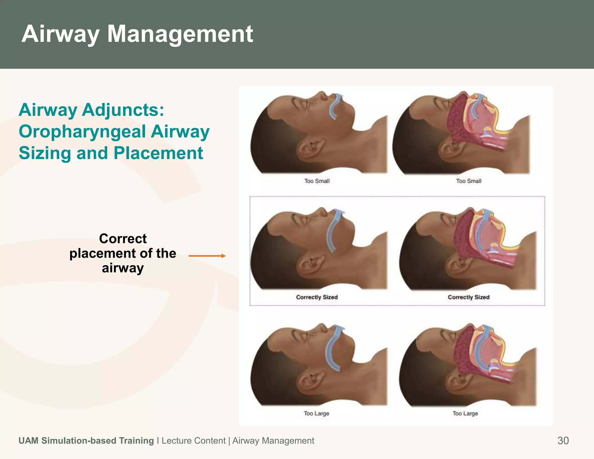 Airway Management | PPTX