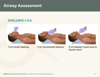 Airway Management | PPTX