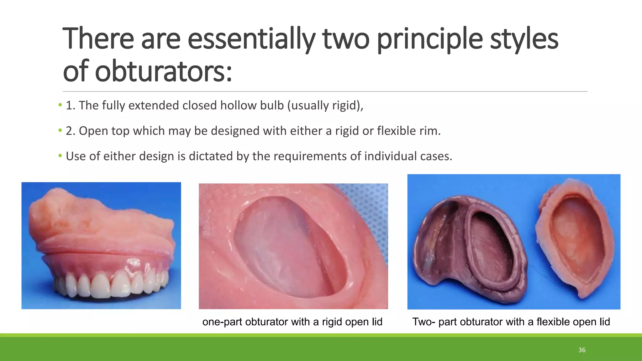 Management of acquired maxillectomy defects with obturators | PPTX
