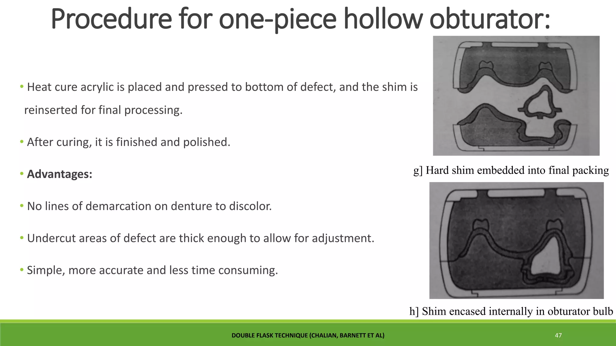 Management of acquired maxillectomy defects with obturators | PPTX