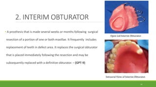 Management of acquired maxillectomy defects with obturators | PPTX
