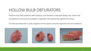Management of acquired maxillectomy defects with obturators | PPTX