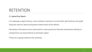 Management of acquired maxillectomy defects with obturators | PPTX