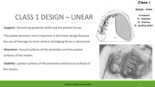 Management of acquired maxillectomy defects with obturators | PPTX
