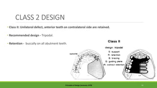 Management of acquired maxillectomy defects with obturators | PPTX