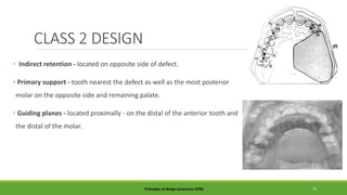 Management of acquired maxillectomy defects with obturators | PPTX
