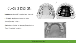Management of acquired maxillectomy defects with obturators | PPTX