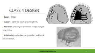 Management of acquired maxillectomy defects with obturators | PPTX
