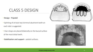 Management of acquired maxillectomy defects with obturators | PPTX