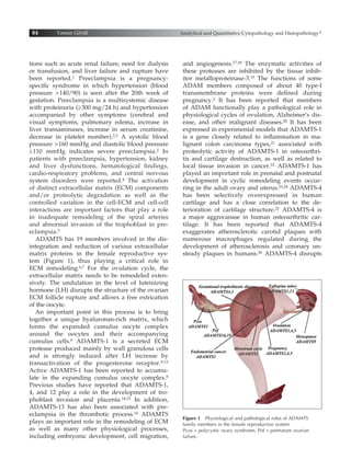 Immunohistochemical Distribution of ADAMTS-1, ADAMTS-4 Expression in ...