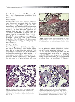 Immunohistochemical Distribution of ADAMTS-1, ADAMTS-4 Expression in ...