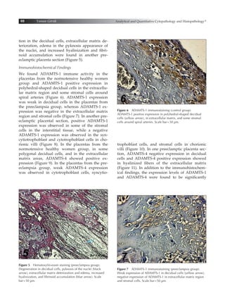 Immunohistochemical Distribution of ADAMTS-1, ADAMTS-4 Expression in ...