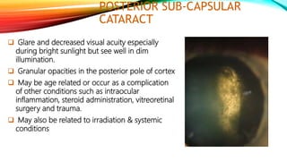 12. Cataract.pptx | Eye and Vision Conditions | Diseases and Conditions