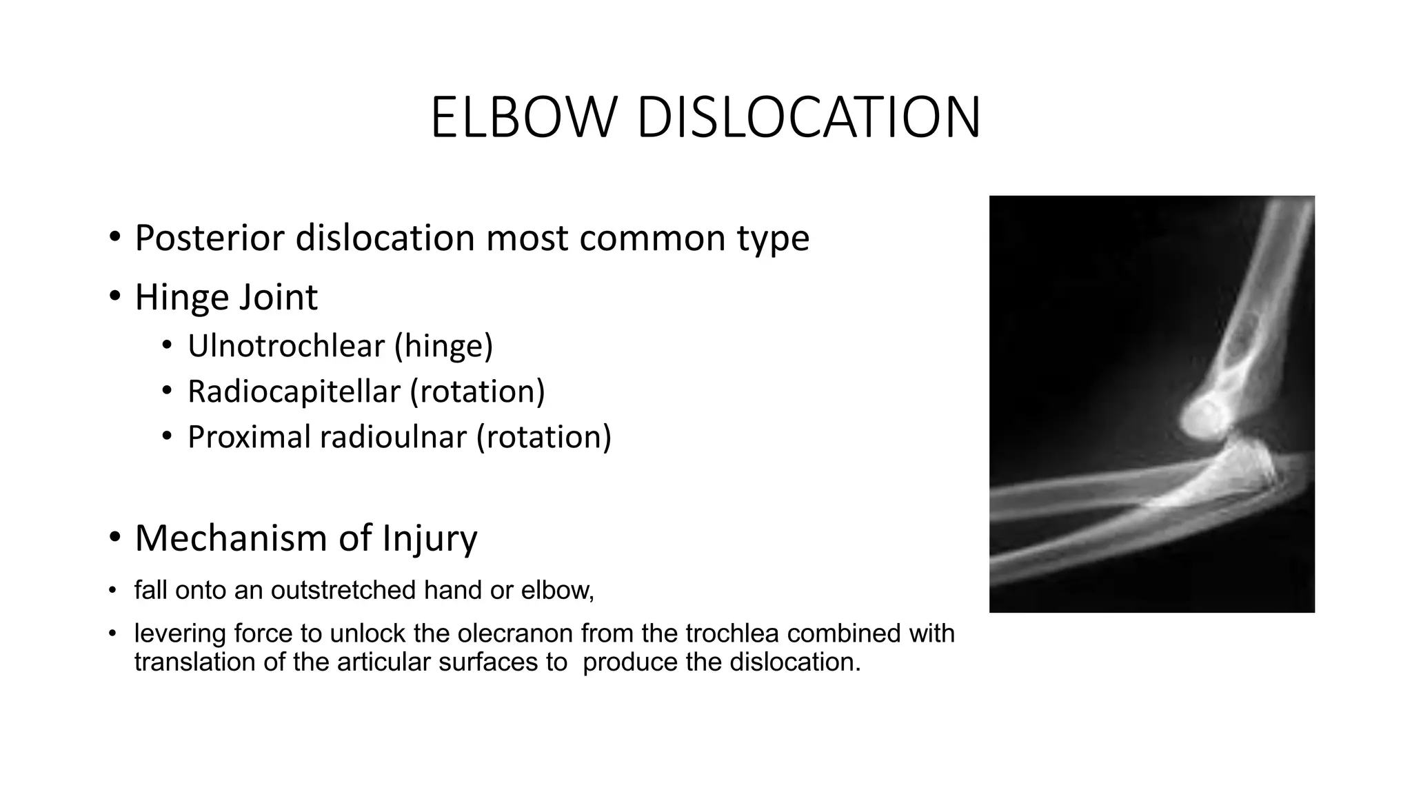 Elbow dislocations, Radial head fractures, olecranon fractures | PPT