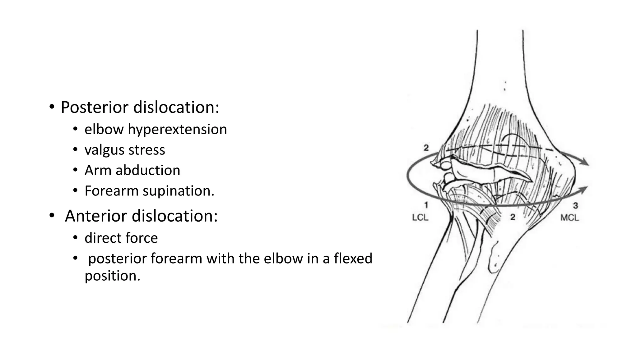 Elbow dislocations, Radial head fractures, olecranon fractures | PPT