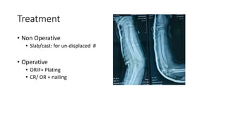 Elbow dislocations, Radial head fractures, olecranon fractures | PPTX
