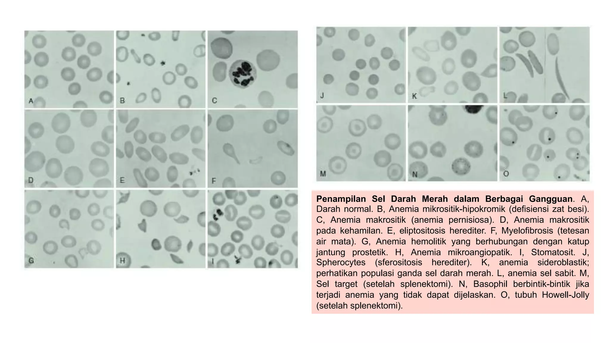 patofisiologi Mikro Mineral (Anemia).pdf