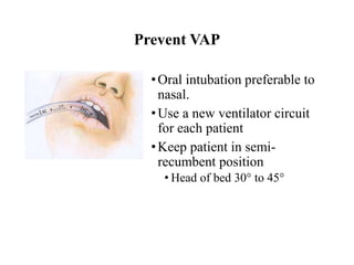 12. Tracheal tubes and prevention of VAP.pptx | First Aid | Injuries