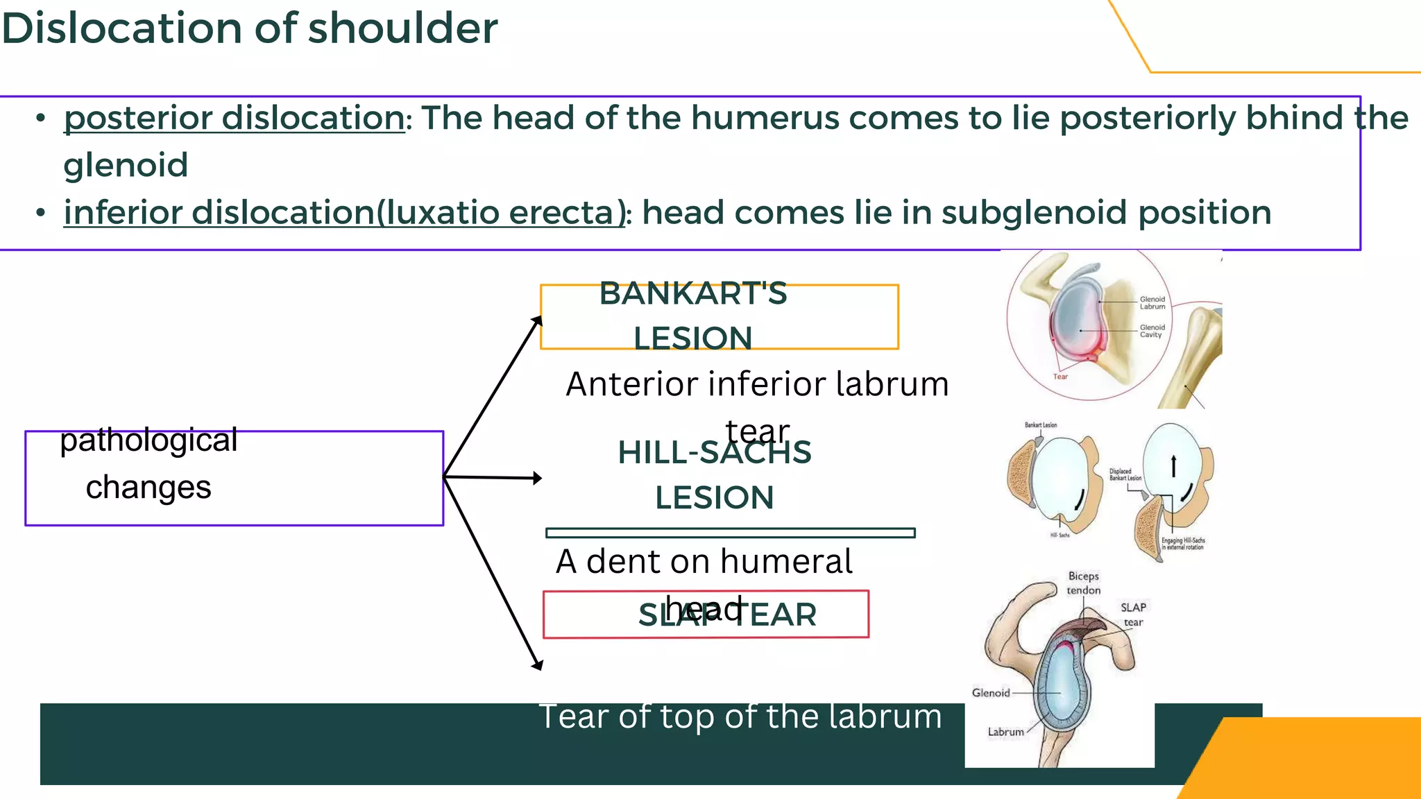 shoulder injury.pptx