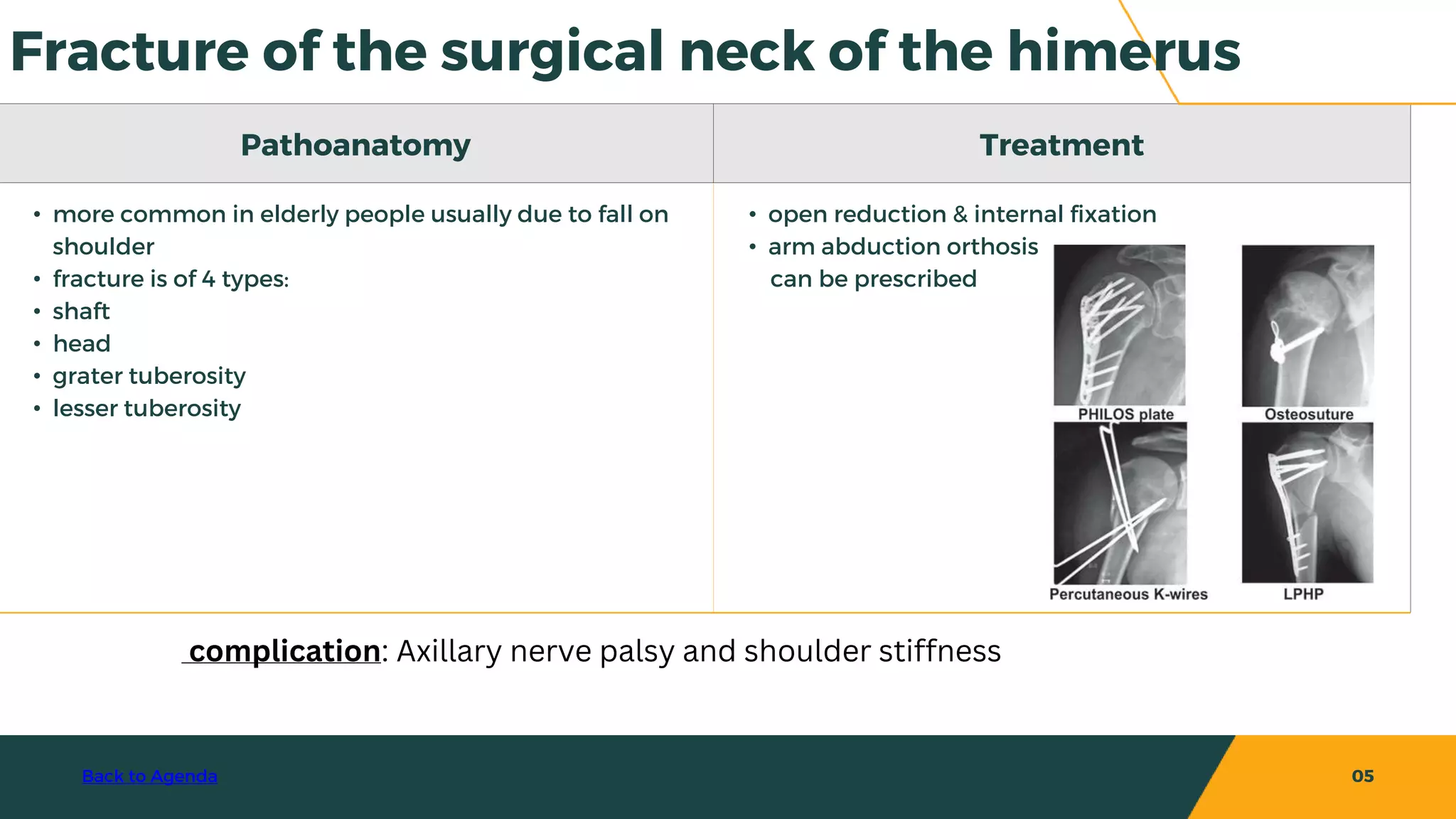 shoulder injury.pptx