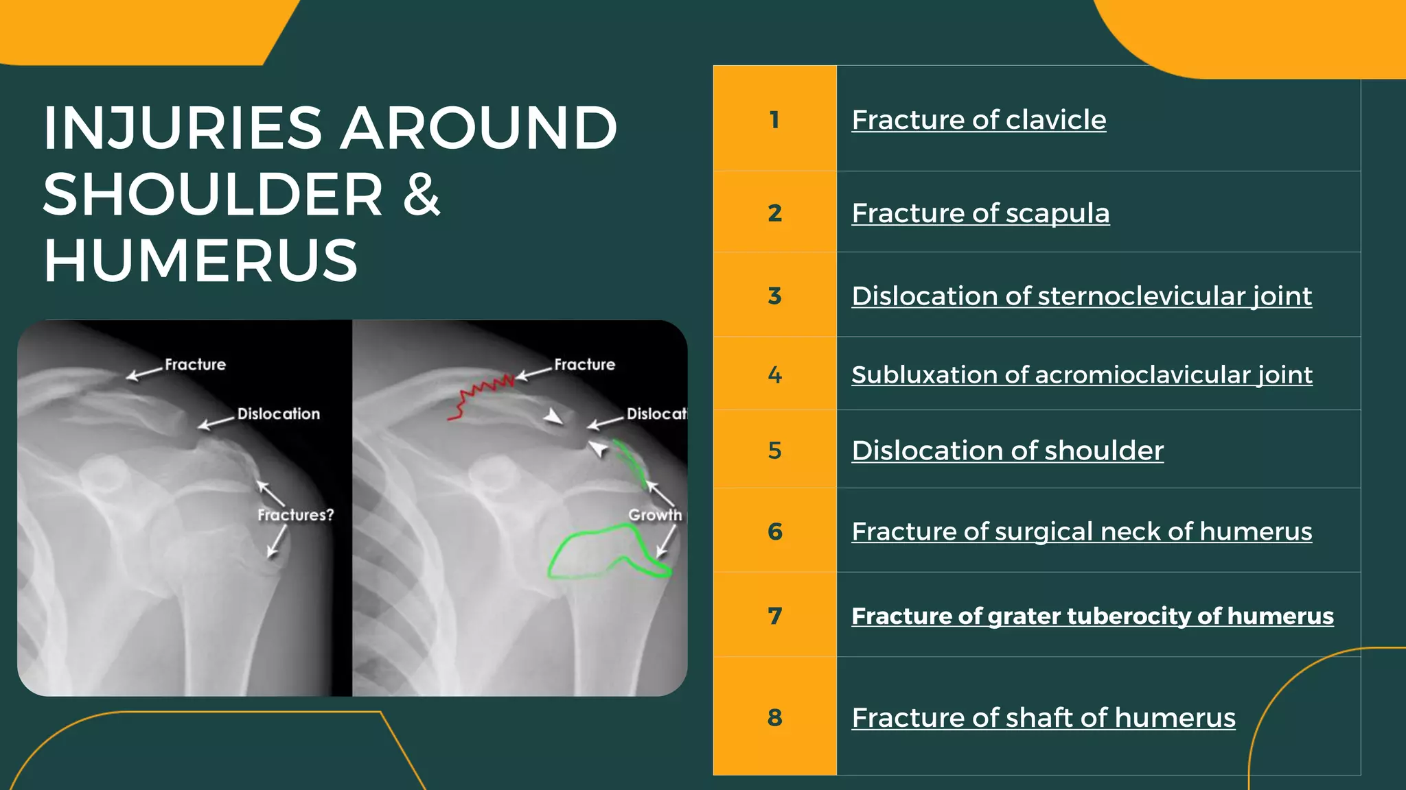 shoulder injury.pptx